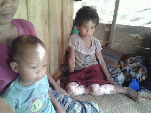 Mengenal Suku Tobalo, Suku di Barru yang Memiliki Ciri Khas di Kulit